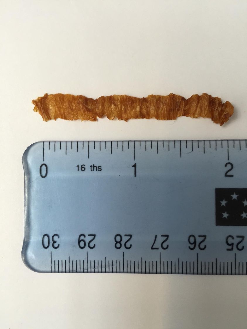 What Is Keratin? | Ear Wax Removal | WaxAxe